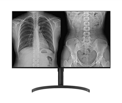 Dicom Displays | Rothband